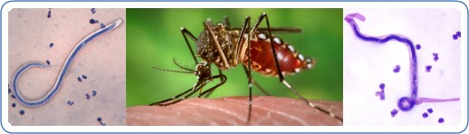 Filariasis, Masihkah Mengancam ? – Perhimpunan Profesional Kesehatan ...