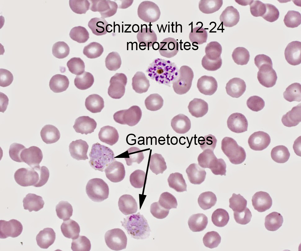 Creepy Dreadful Wonderful Parasites: July 2014