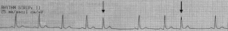 ER goldbook: EKG interpretation