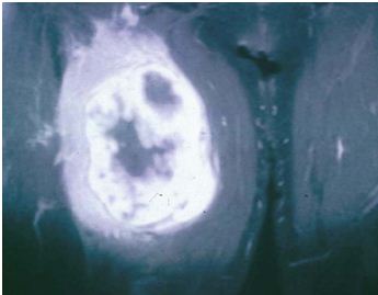 Dr Herry Setya Yudha Utama SpB. FInaCS. MHKes. ICS: ONCOLOGY ...