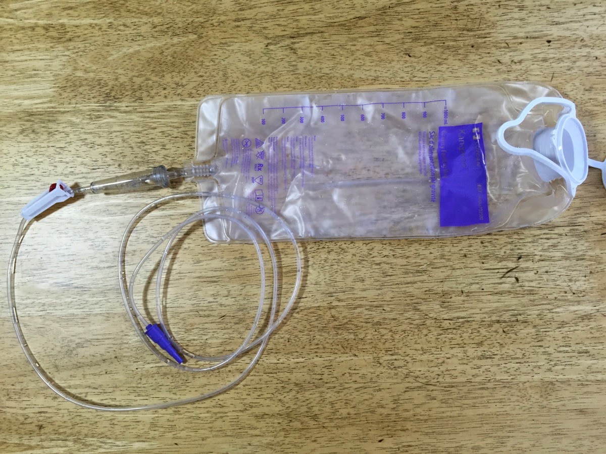 Life in the Land of Wa: VACTERL Association