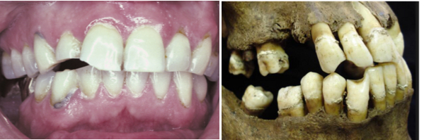 SearchReSearch: Answer: Body modifications?