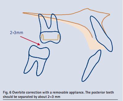 Dentistry lectures for MFDS/MJDF/NBDE/ORE: An Illustrated Note on ...
