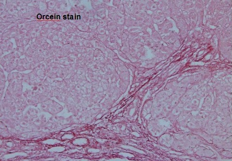 My Gastro Room: April 2013