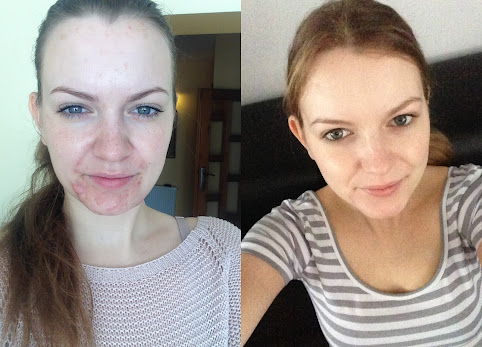 Basia Smoter Blog - blog kosmetyczny, blog lifestylowy. Opinie, trądzik ...