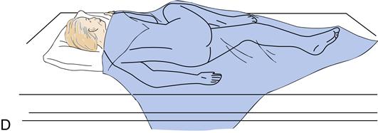 POSIÇÃO SIMS | ENFERMAGEM CONTINUADA