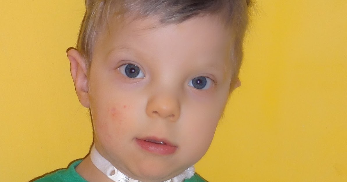 CASPER WORLD : KACPER’S STORY