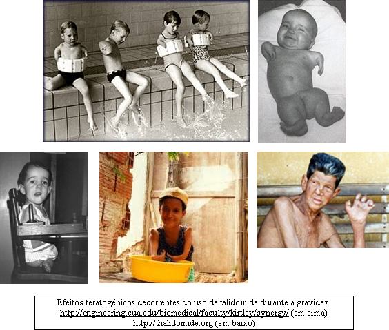 A Terra Média de Claudia: Os Bebês da Talidomida