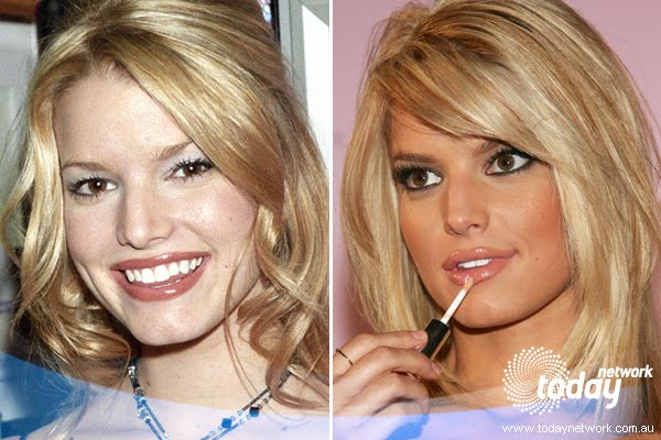 Picture Gallery: Celebrities Jessica Simpson Before & After Plastic Surgery