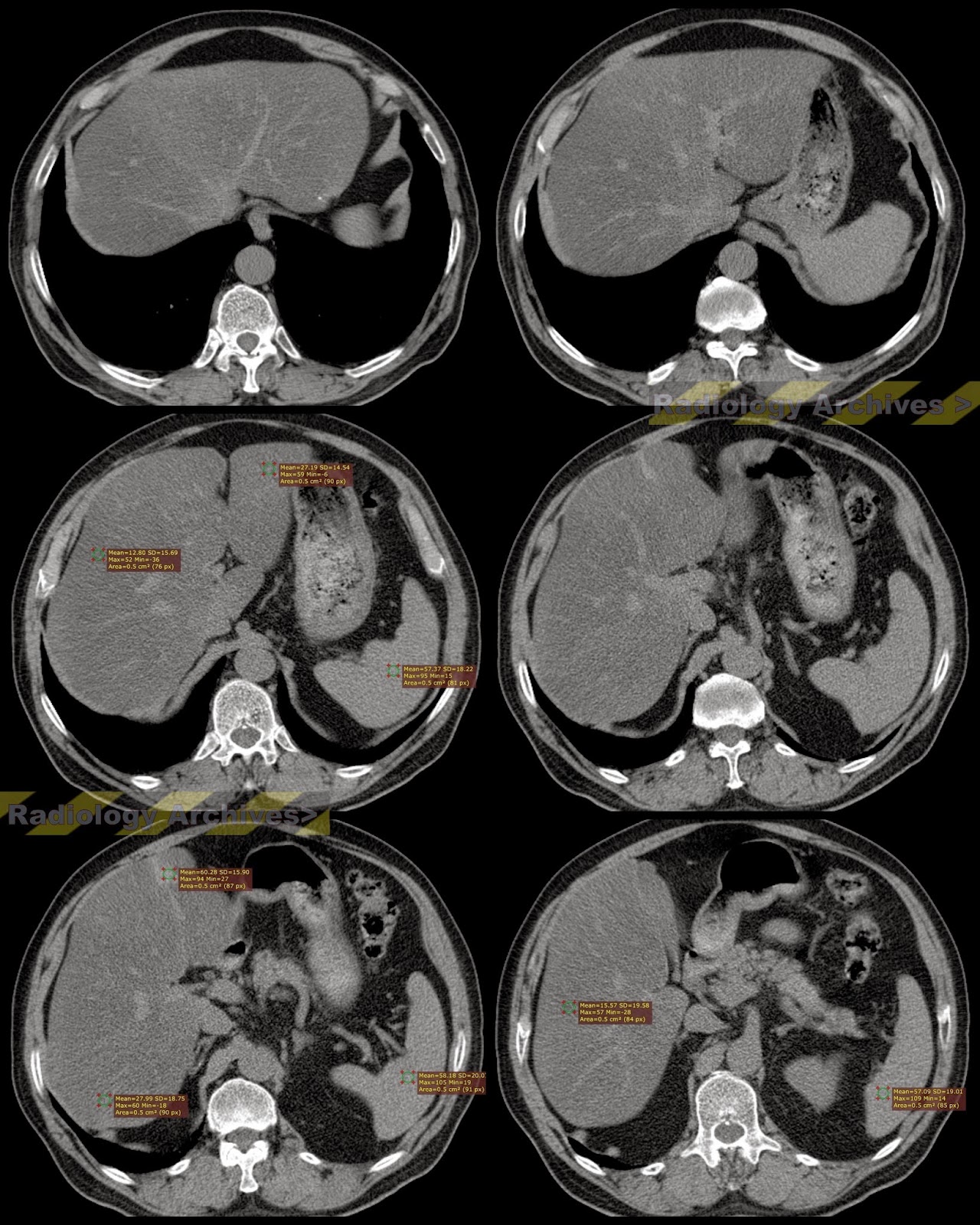 Radiology Archives: Οκτωβρίου 2014