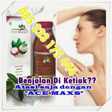 Cara Menghilangkan Benjolan Di Ketiak ~ Obat Herbal Gondok Beracun