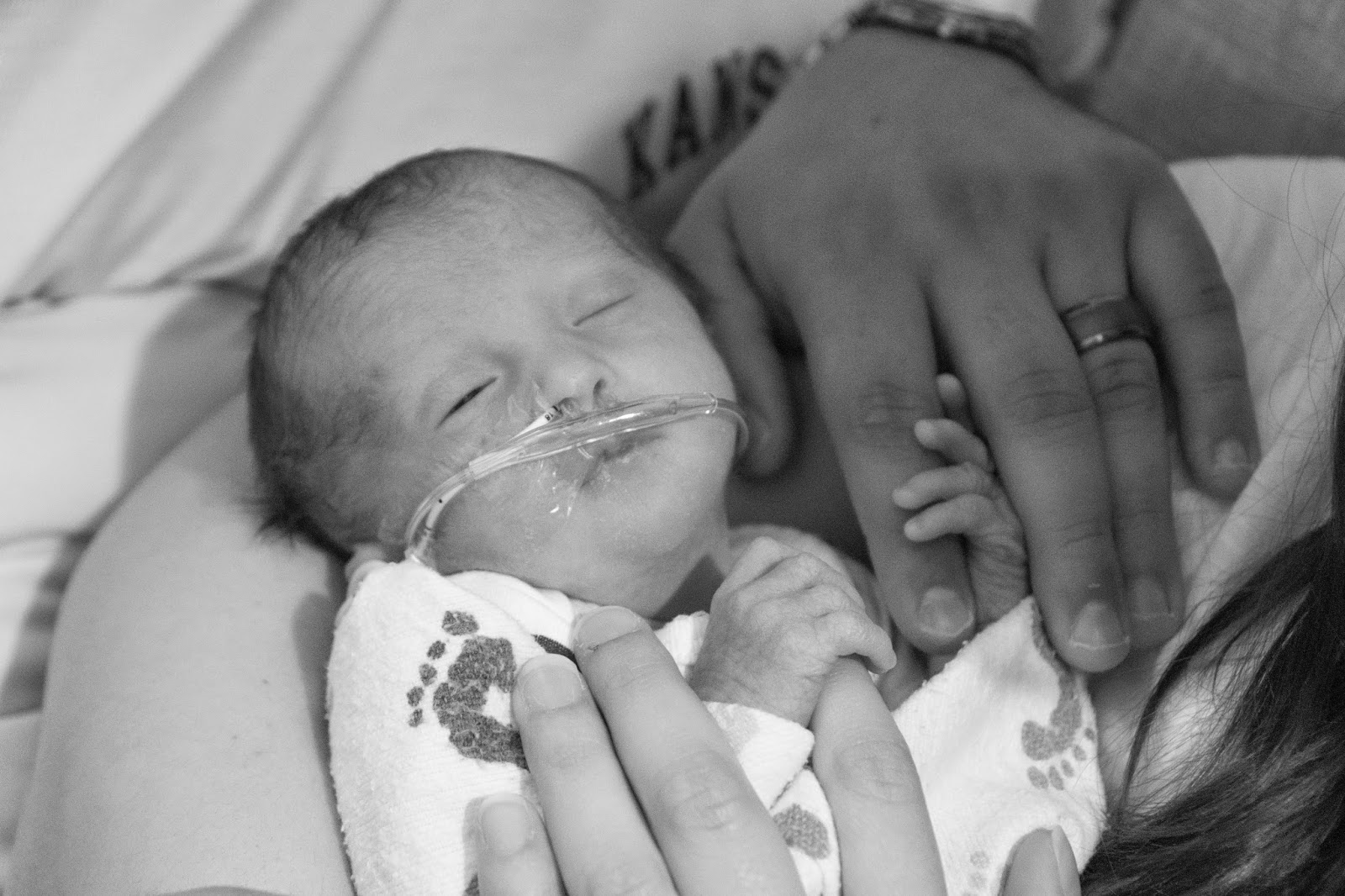 Cherishing Elise: Carrying and Loving Our Trisomy 18 Baby: Photos from ...