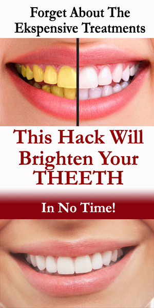 Yellow Teeth? Try This Hack! It Actually Works!