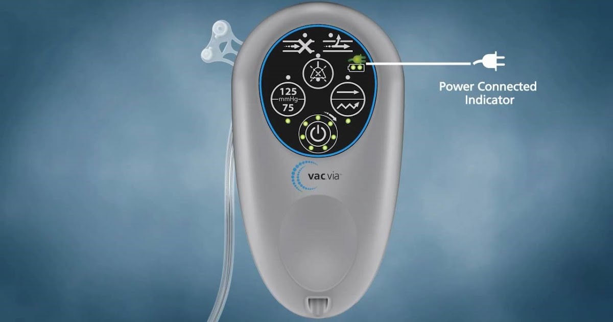 傷口大師: 2016年，進化版的術後傷口負壓系統Prevena plus