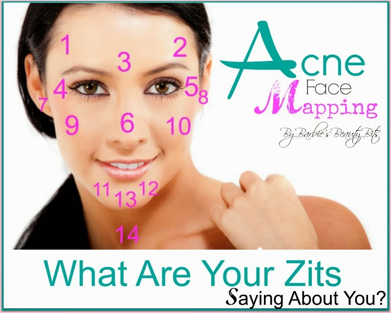 Acne Face Mapping: What Are Your Zits Saying About You? | Barbie's ...