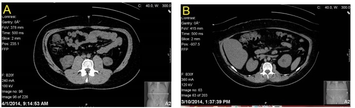 Utilization of Milk as an Oral Contrast Agent in CT Scan of the Abdomen ...