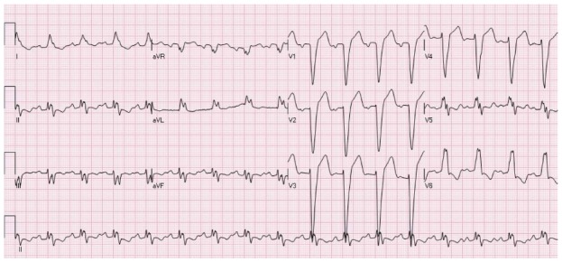 ER goldbook: EKG interpretation