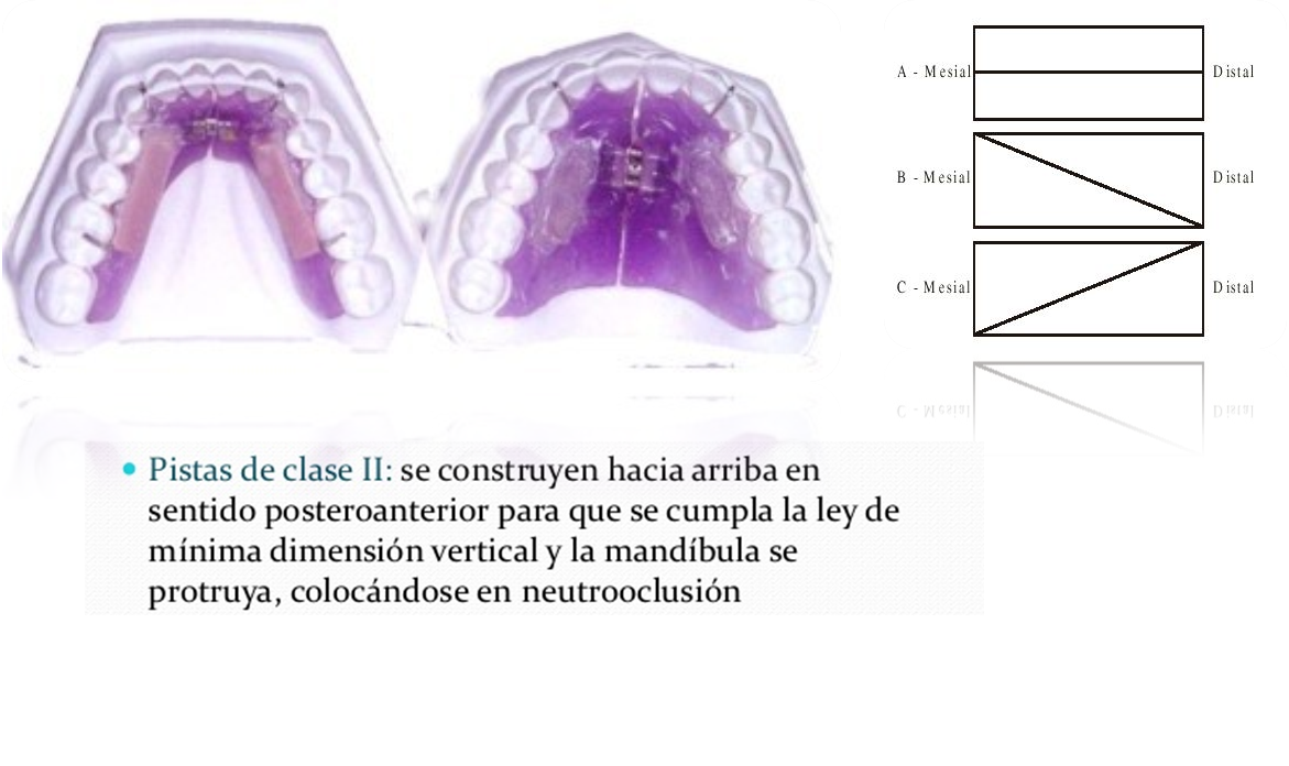 MALOCLUSIONES CLASE II