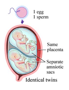 Multiple Pregnancy | Nurselk.com