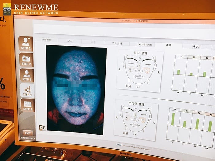 Renewme Skin Clinic: Skin Analysis System from Renewme Skin Clinic