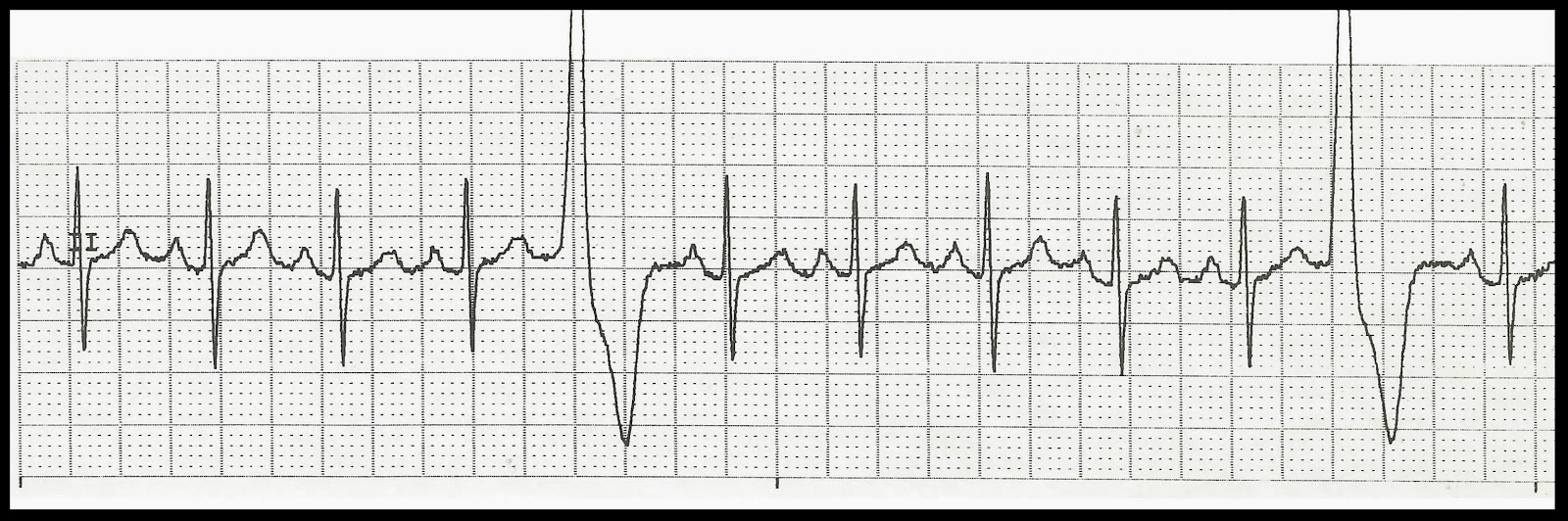 Practice Rhythm Strips 283