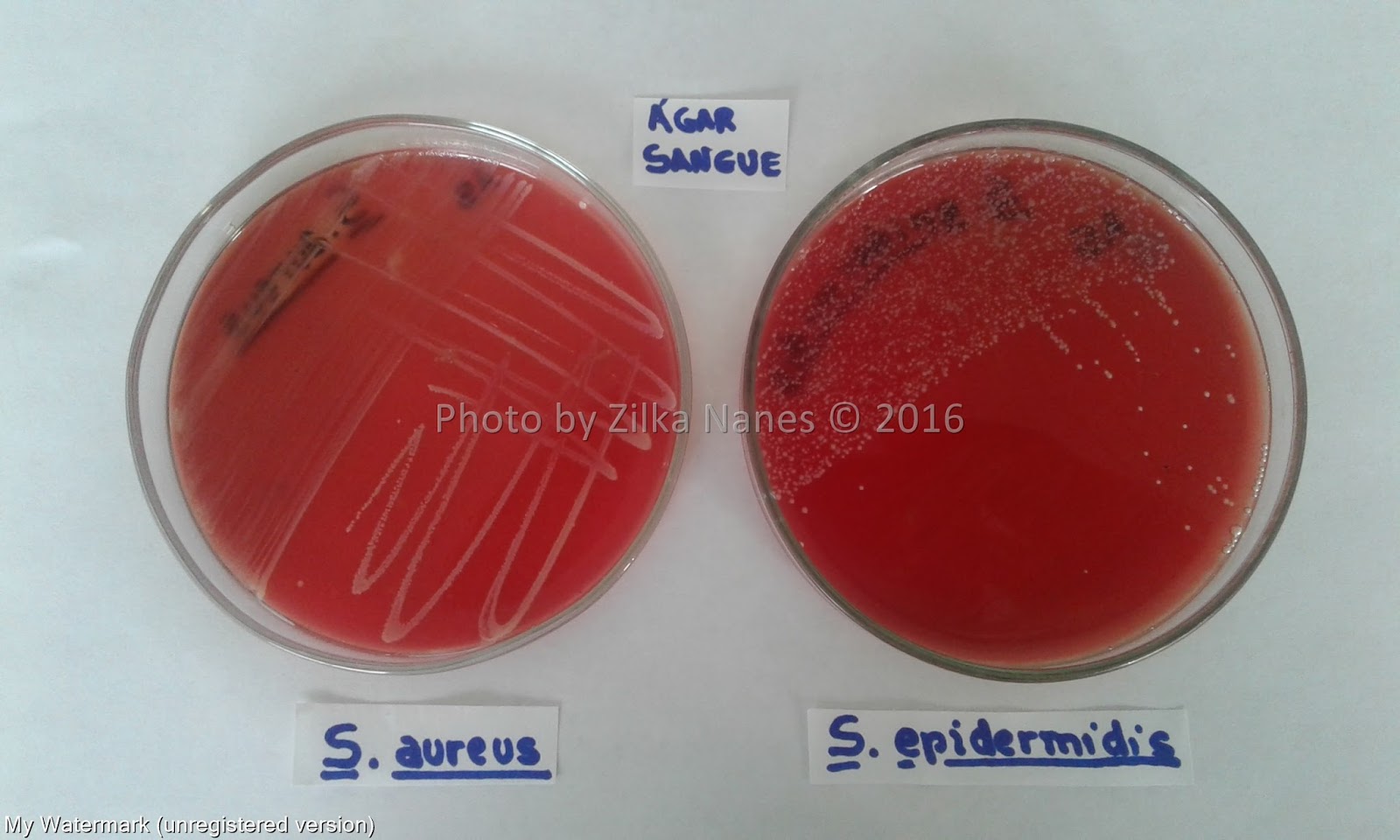 11. IDENTIFICAÇÃO DE COCOS GRAM-POSITIVOS