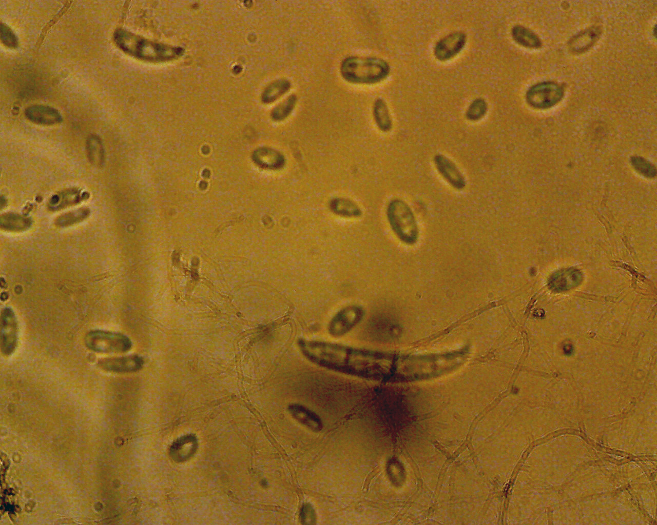 Langkah mudah menghitung spora menggunakan hemasitometer - Maroon Wasp ...