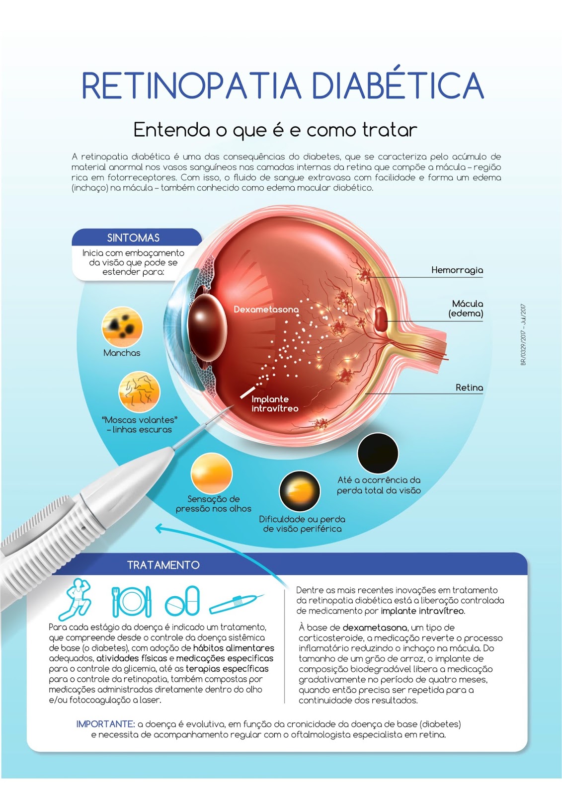 Blog Jornal da Mulher: Retinopatia diabética afeta uma das principais ...
