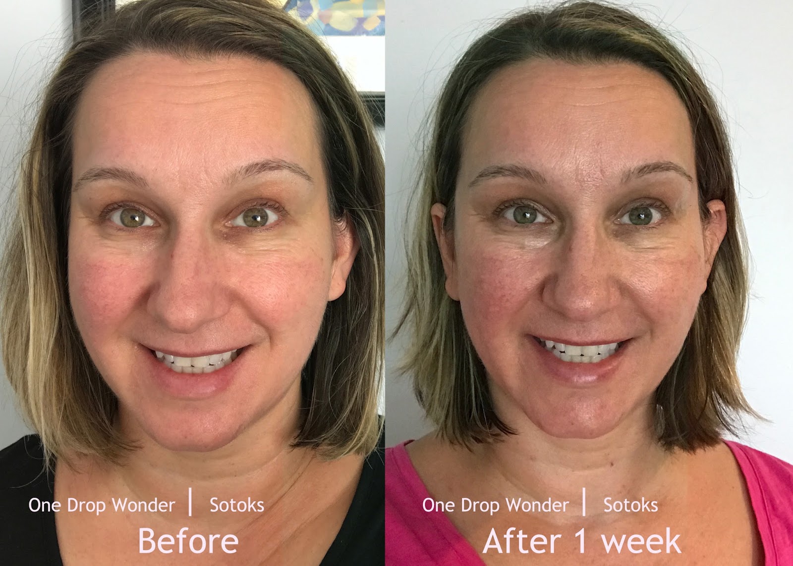 Before and After - Limelight by Alcone - One Drop Wonder and Sotoks ...