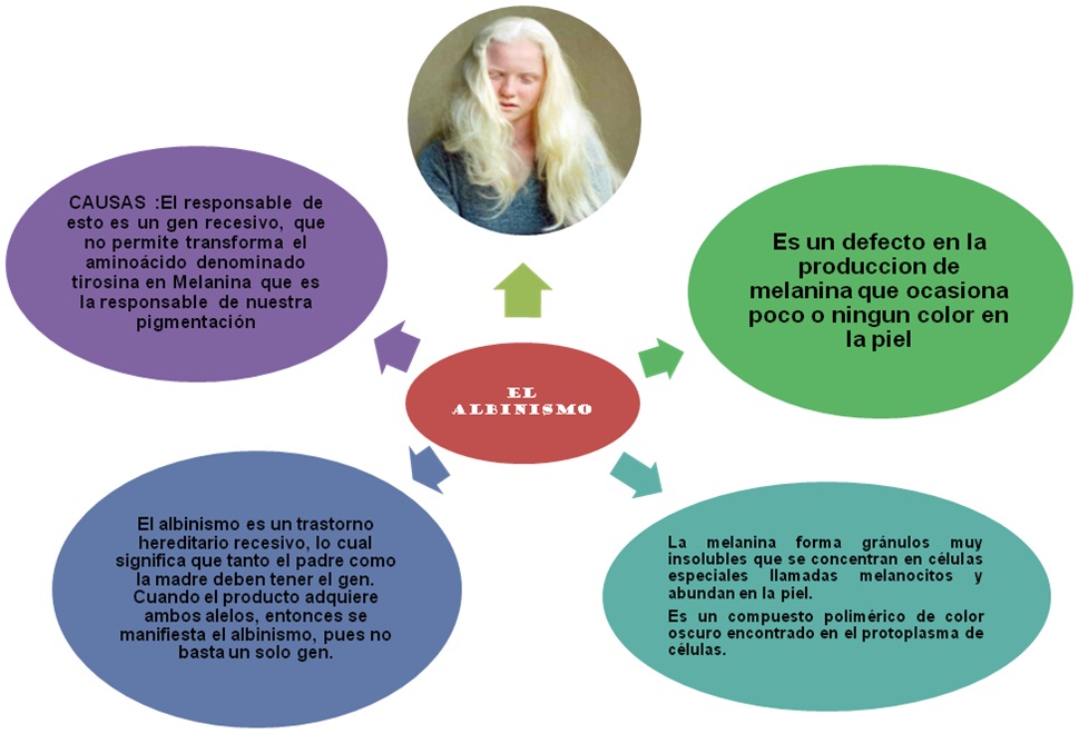 DÉFICIT DE MELANINA EN ALBINOS: ¿QUÉ ES EL ALBINISMO?