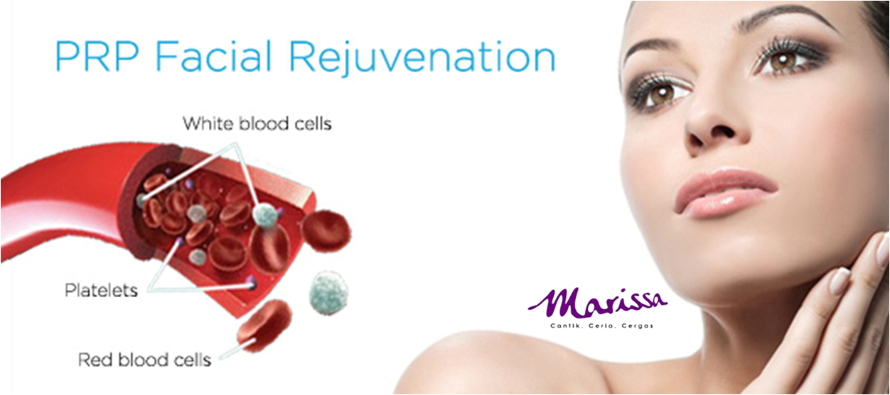 PLATELET RICH PLASMA (PRP): PRP for Anti Aging