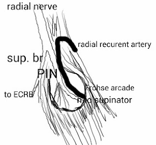 POSTERIOR INTEROSSEOUS NERVE SYNDROME - DNB Orthopaedics MS Orthopedics ...