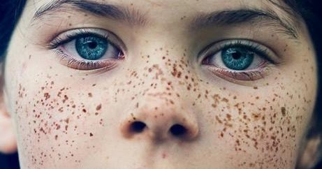 Dinero y yo: Cómo quitar las pecas de la cara