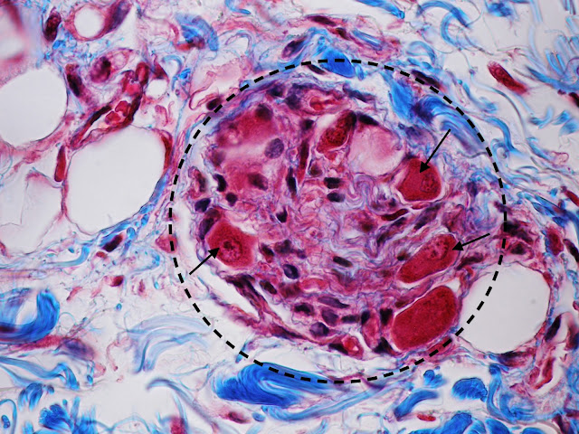 SOS BIOLOGIA CELULAR Y TISULAR: CORAZON. EPICARDIO