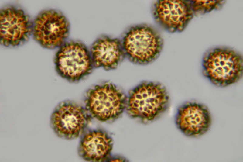 El mundo microscópico de los hongos: Pisolithus arhizus (Scop.per Pers ...