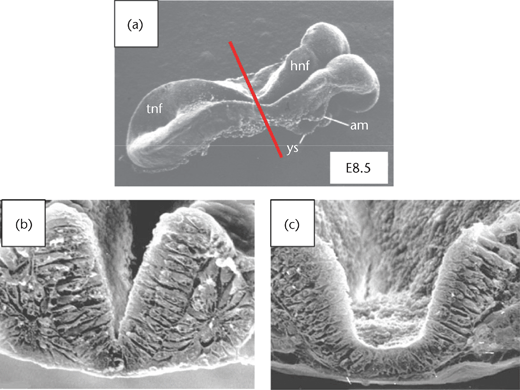 NEURULASI ~ Human's Development