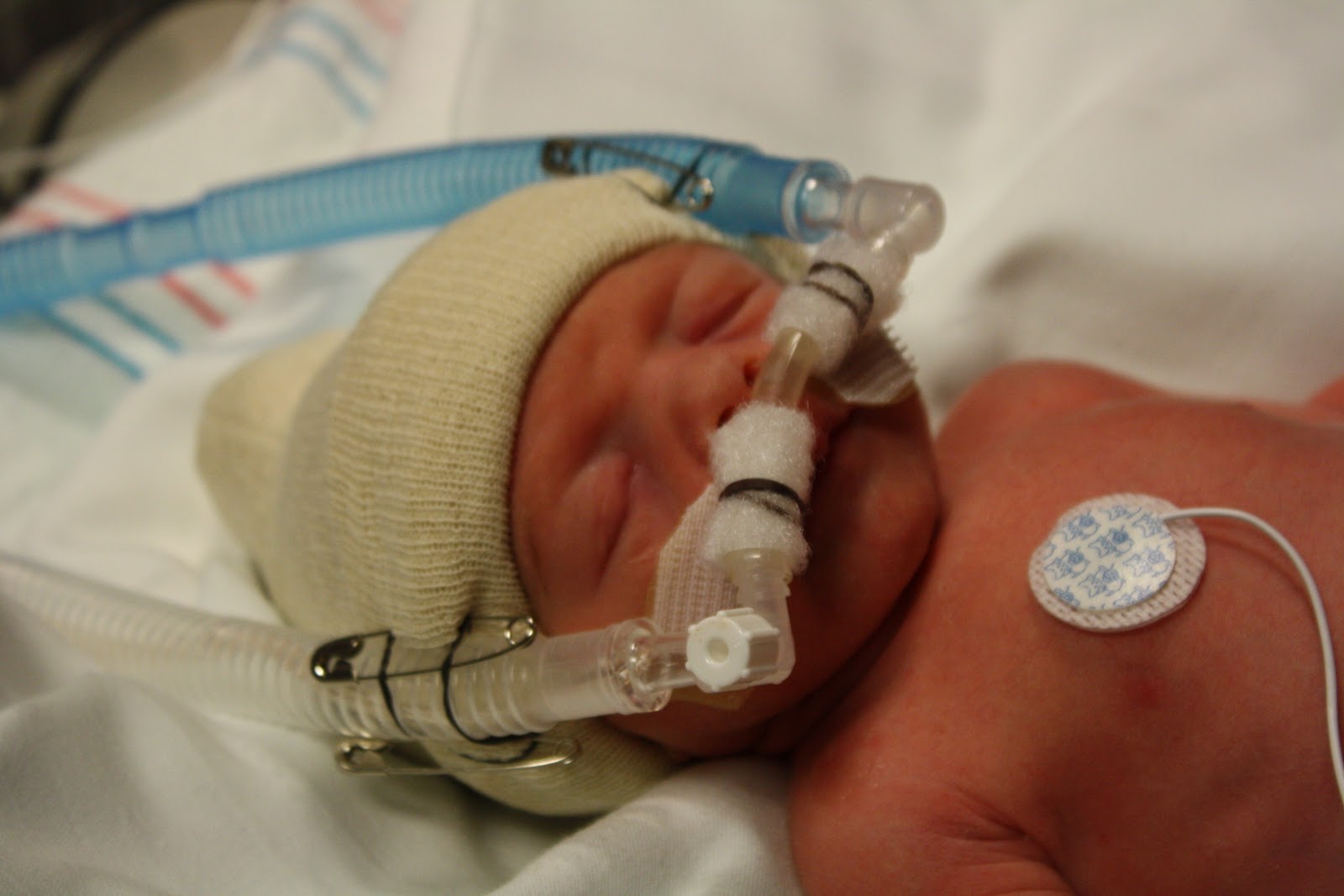 Baby Kylee: Kylee - Day 3