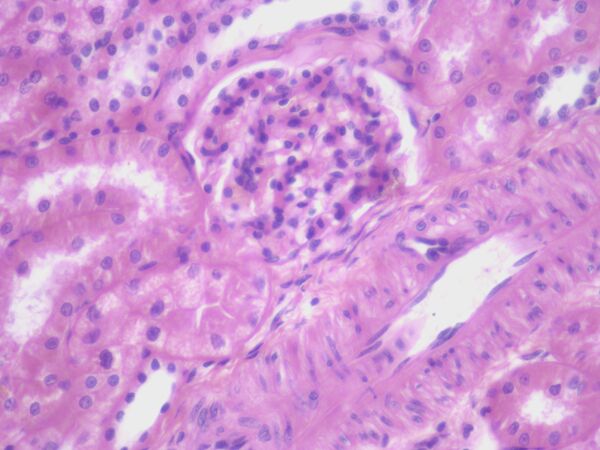 Histología - Fisioterapia IIIB: TEJIDO EPITELIAL