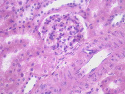 Histología - Fisioterapia IIIB: TEJIDO EPITELIAL