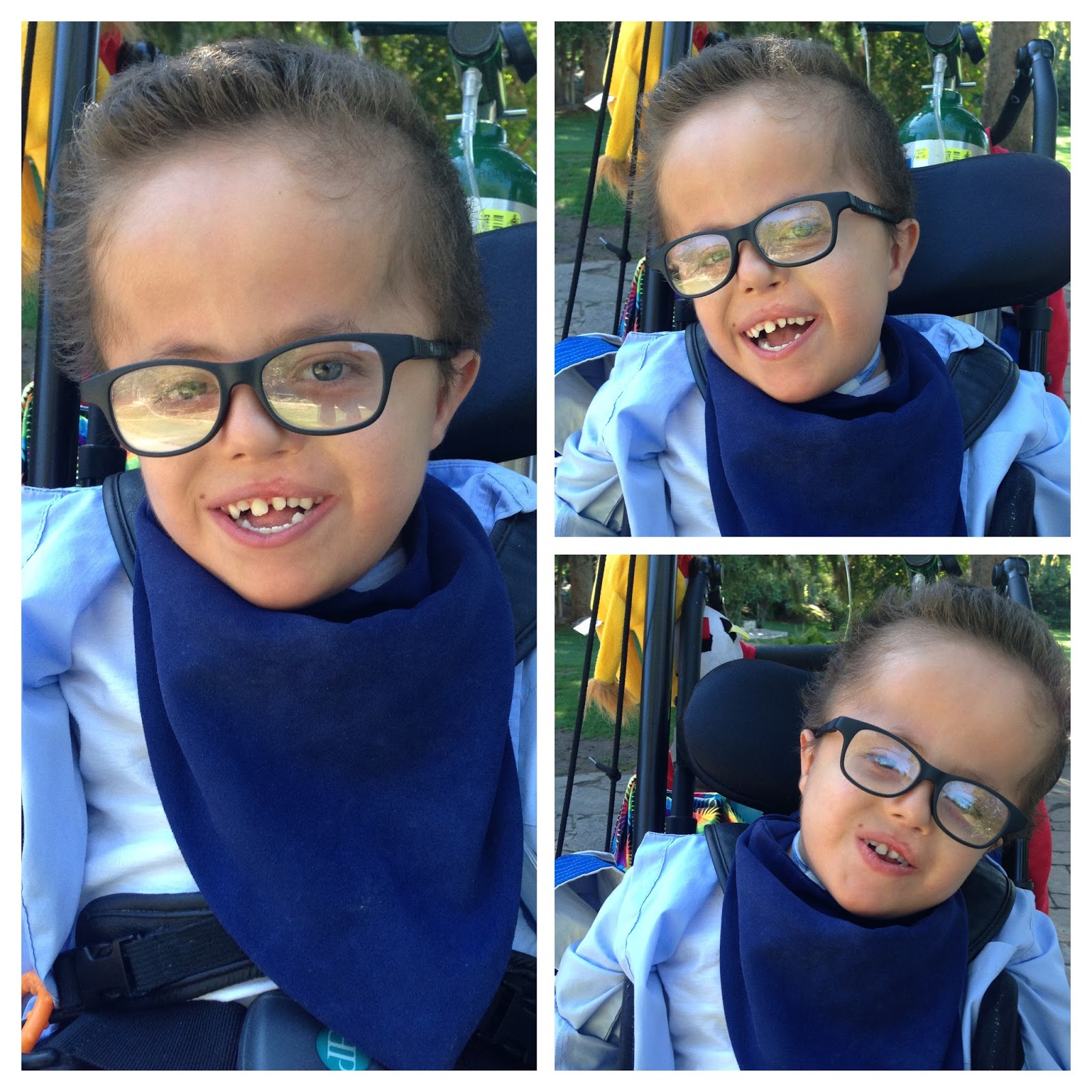Compatible With Joy-Trisomy18: Too Smart