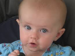 Alevas.com.mx: Macrocefalia