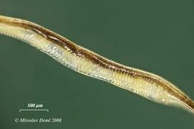 Invertebrados: Classe Adenophorea