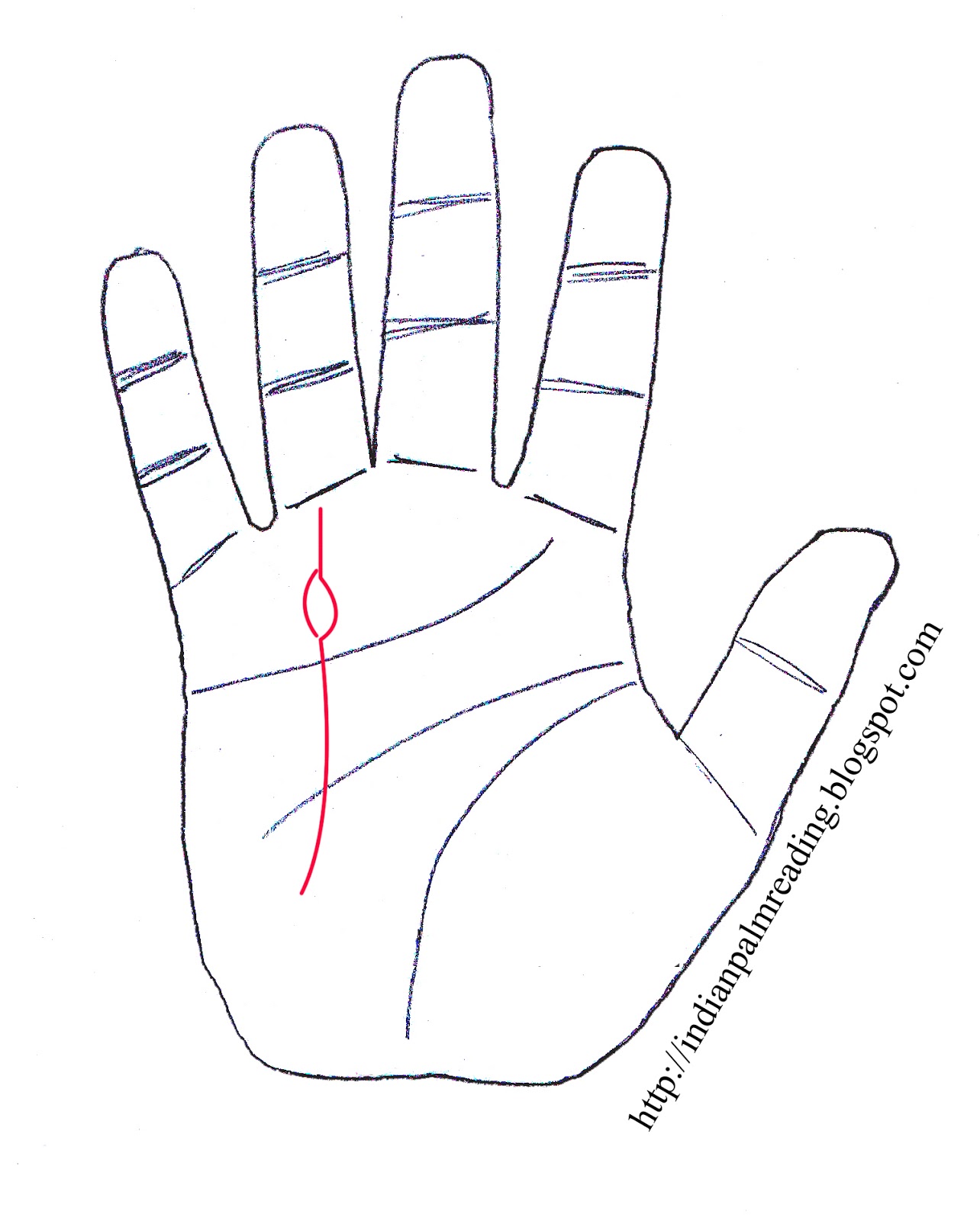 Island on Sun Line Palmistry ~ INDIAN PALMISTRY | PALM READING | HAST ...