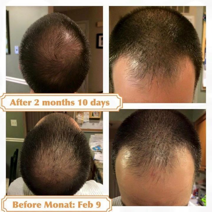 MONAT Global Revolutionary Hair Care Products: Amazing MONAT Before and ...