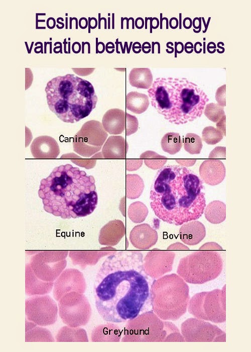 Medical Laboratory and Biomedical Science: Eosinophil morphology ...