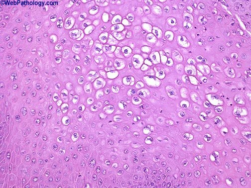 Patología: septiembre 2013