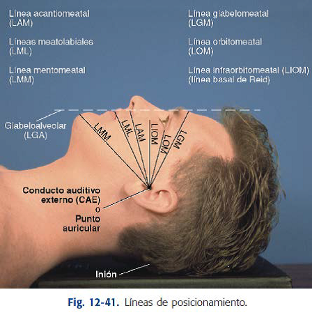 PRODUCCION Y TRATAMIENTO DE IMAGENES DIAGNOSTICAS: CAPITULO CRÁNEO Y ...