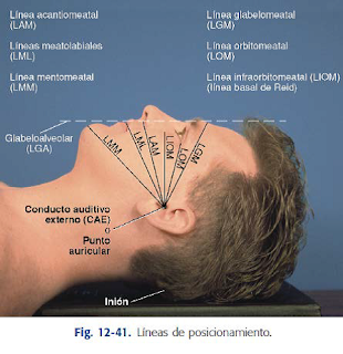PRODUCCION Y TRATAMIENTO DE IMAGENES DIAGNOSTICAS: CAPITULO CRÁNEO Y ...