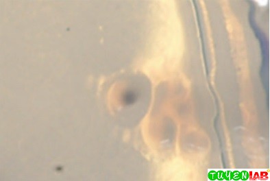 [Microbiology] Atlas of Anaerobes of Clinical Importance | Free Medical ...