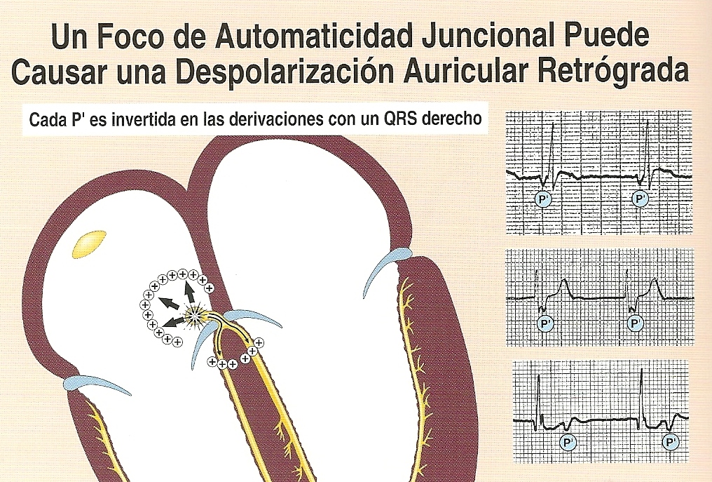 Dr. Rafael Soto - Electrocardiografía - Cardiología clínica: Complejo ...
